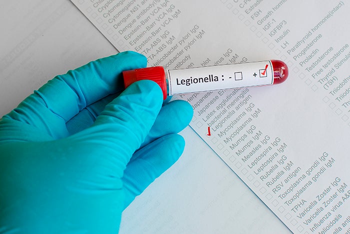 CDC works to prevent Legionella and a multidrug-resistant fungus in ...